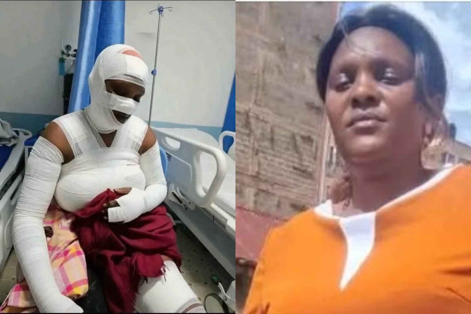 Ruto's Supporter Dead After Acid Attack